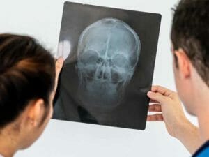 What Is The Most Common Brain Injury? | Most Common TBI